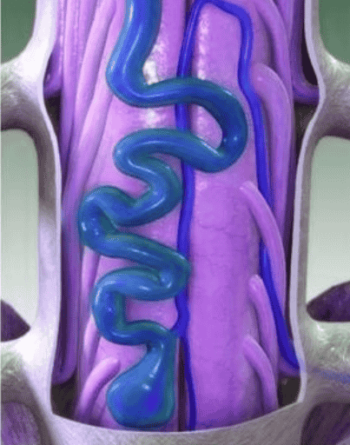 Spinal Cord AVMs – Symptoms, Causes & Best Treatment | Dr. Rajeev ...